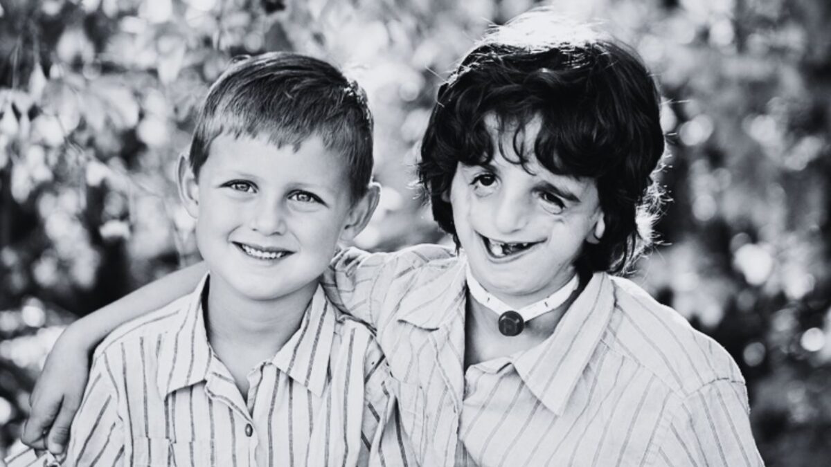 Nathaniel Newman: Overcoming Treacher Collins Syndrome